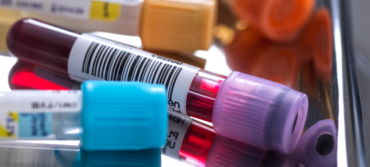 Exame de Ureia: Descubra sua Importância e Funcionalidades